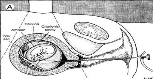 BME240-Kniazeva-Home